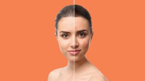 Early Diagnosis with Dermo Direct: Key to Skin Health